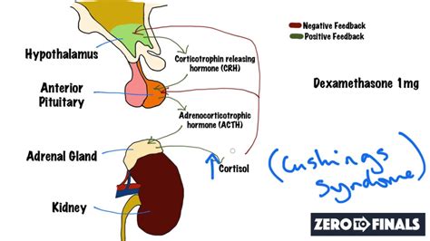 Understanding The Dexamethasone Suppression Test Youtube