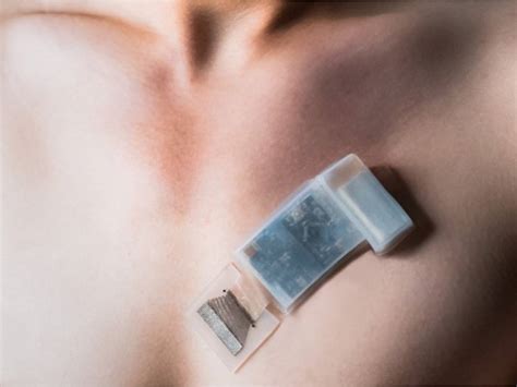 New Wearable Ultrasound System Can Monitor Bp Heart Function On The Go