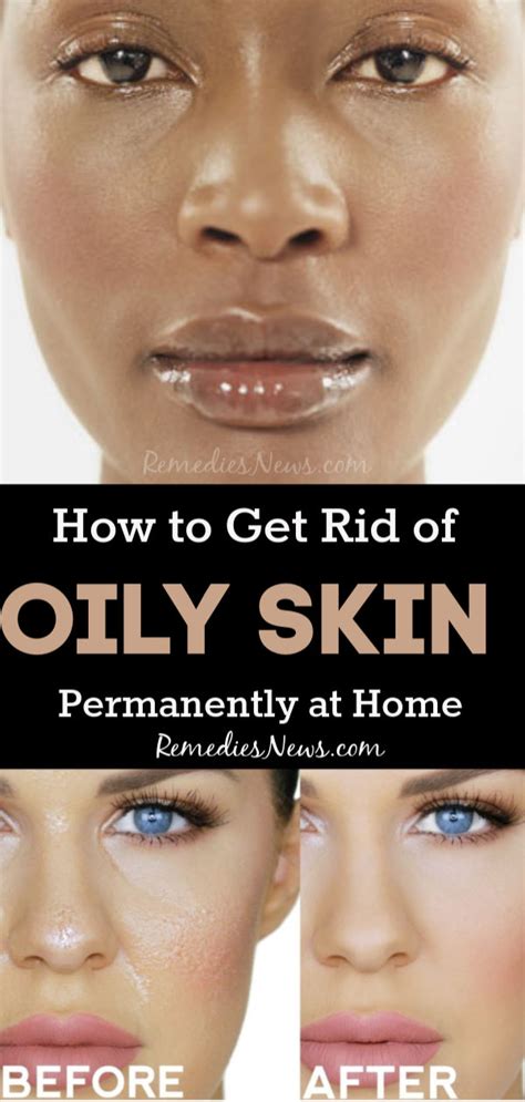 How To Get Rid Of Oily Skin Fast At Home 9 Best Natural Remedies