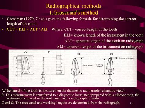 Working Length Estimation In Endodontic Pptx