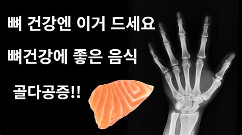 뼈건강에 좋은 음식 Youtube