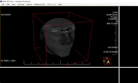 Leadtools 22 套件 Leadtools 超级套leadtools 22 Downalod Csdn博客