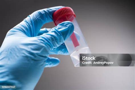 Dokter Tangan Dengan Sampel Tinja Foto Stok Unduh Gambar Sekarang