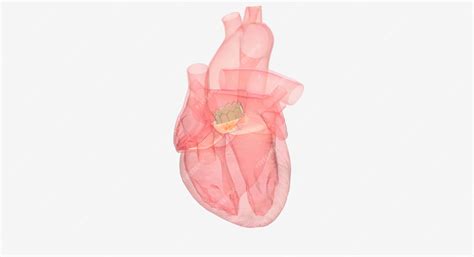 Premium Photo The Transcatheter Aortic Valve Replacement