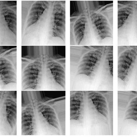 example of data augmentation the first image is the original and the