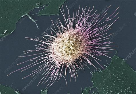 Cervical Cancer Cells Sem Stock Image C056 8088 Science Photo Library
