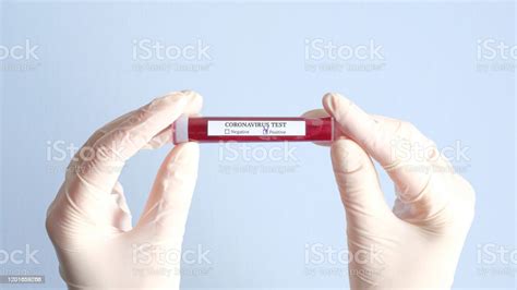긍정적 인 코로나 바이러스 혈액 검사 결과와 시험관을 들고 의료 장갑에 손 중국 우한 바이러스 발생 2019ncov 생화학 혈액