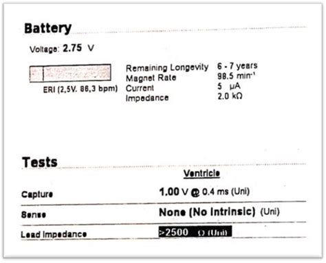 Setting Of The Permanent Pacemaker Activity Before Reimplantation Found