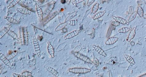 What Are Diatoms Diatoms Of North America