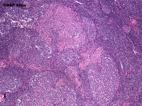 Hsp Atlas Histopathology Atlas