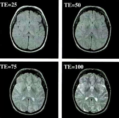 13 4 MRI Weightings BS2010 Bioimaging