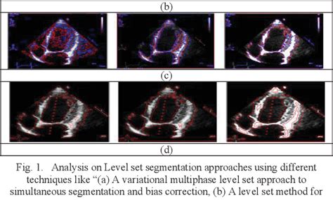 A Study On Various Segmentation Approaches Using Echocardiogram Images