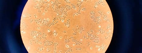 可诱导t细胞共刺激分子：免疫刺激或免疫抑制的目标？