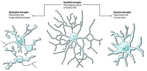 The Impact Of Chronic Inflammation On Brain Health And Ways To Combat It Very Big Brain