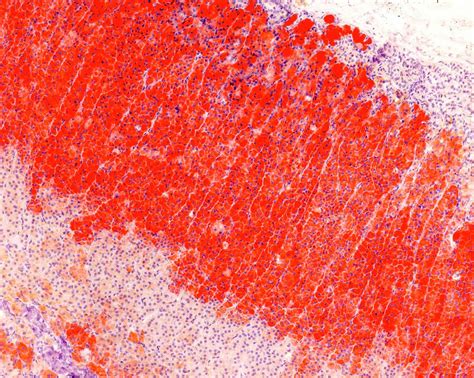Adrenal Gland Photograph By Jose Calvo Science Photo Library Pixels