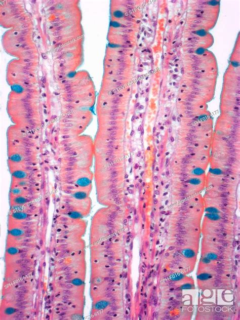 Small Intestine Light Micrograph Lm Of A Section Through The Finger