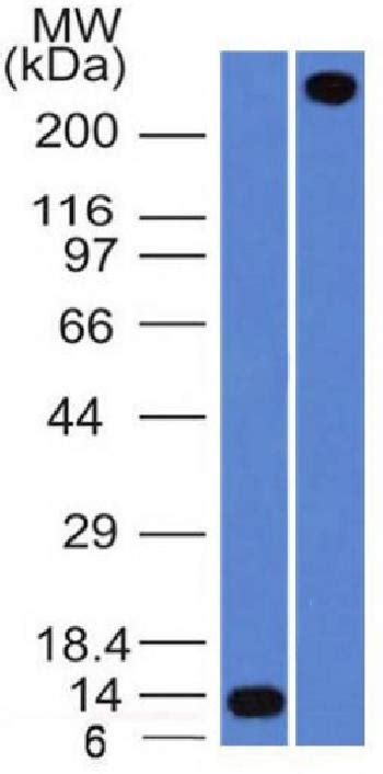 Anti Von Willebrand Factor Factor Viii Related Ag Antibody
