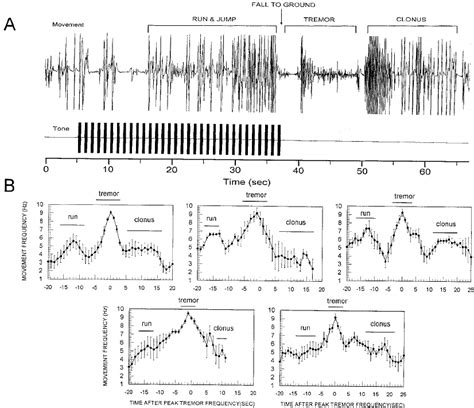 Temporal Structure Of The Myoclonic Seizure Of The Gepr3hsd Rat A Download Scientific
