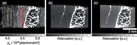 Implementation Of A Double Grating Interferometer For Phase Contrast Computed Tomography In A
