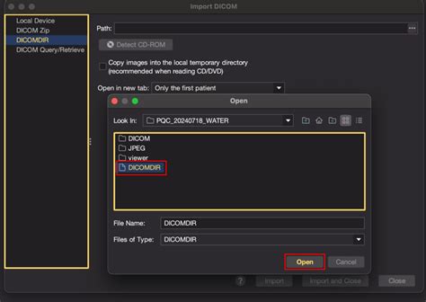 Weasis User Guide Nus Tmr
