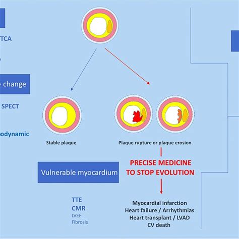 Proposition Of Non Invasive Multimodality Imaging Strategy To Detect Download Scientific