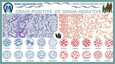 Conjugated Bilirubin Vs Unconjugated Bilirubin Lab Tests Guide