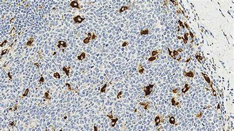 Cd68 Ihc Primary Antibodies