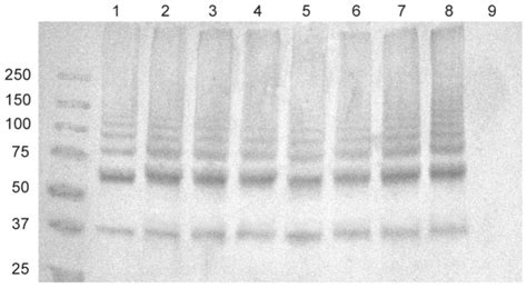 Sds Page Of Mutanolysin Extracted Surface Proteins And Western Blotting