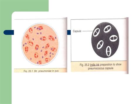 Pneumococcus Ppt Lung And Respiratory Health Diseases And Conditions