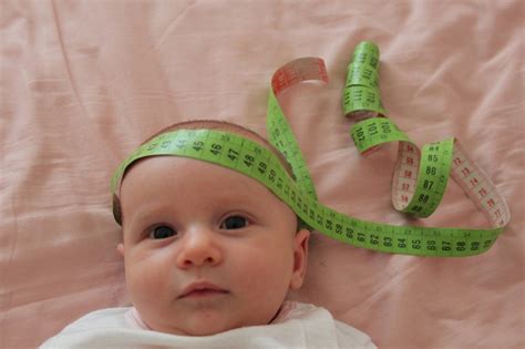 What Is Microcephaly Disease What Are The Symptoms Of Microcephaly