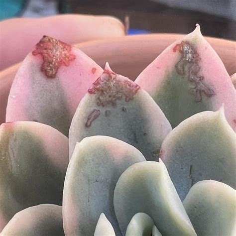 Sunburn Edema Both Rsucculents