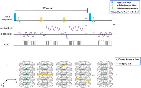 A Pulse Sequence Diagram For The Proposed Mt‐me Technique Download Scientific Diagram