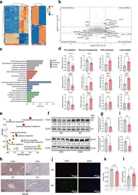 国自然热点 巨噬细胞与细胞代谢 Mettl14通过myd88 Nf κb通路调控s100a4 巨噬细胞参与非酒精性脂肪肝发生发展的机制研究 知乎