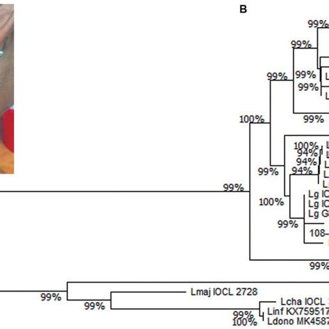 Lesion Appearance And Parasitic Classification Of The Isolated And