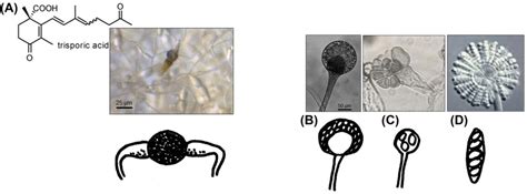 Zygomycota Sporangium