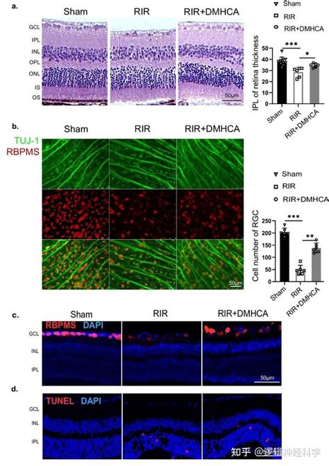 J Neuroinflammation︱中山大学卓业鸿苏文如团队揭示dmhca或可有效减轻视网膜缺血再灌注损伤中神经元死亡和视网膜炎症 知乎