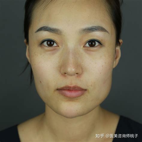 做磨骨要多少钱 知乎