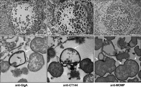 Transmission Immunoelectron Microscopy Shows Globular Structures In The Download Scientific