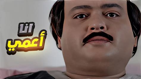 أكتشف انه مش هيقدر يشوف تاني 😱 أصعب لحظة ممكن تعدي على الإنسان Youtube