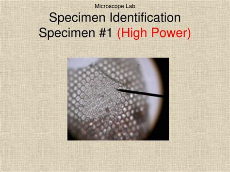 Ppt Microscope Lab Specimen Identification Specimen 1 High Power