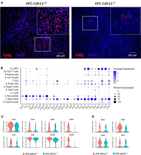 Loss Of Cadherin 11 In Pancreatic Ductal Adenocarcinoma Alters Tumor