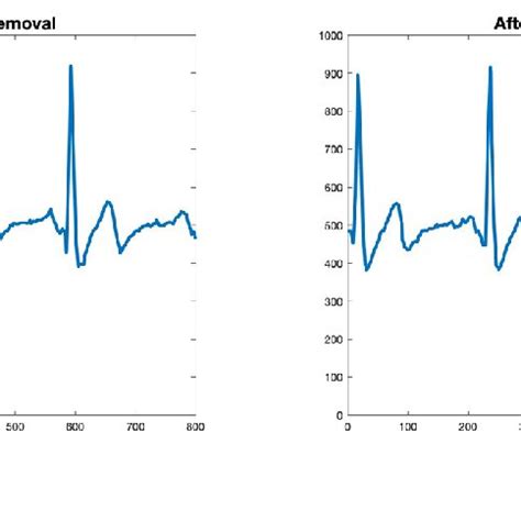 Example Of Artifacts Removal A Before Artifact Removal B After