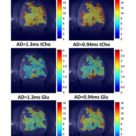 Representative Metabolic Maps Obtained From The Lcmodel Quantification