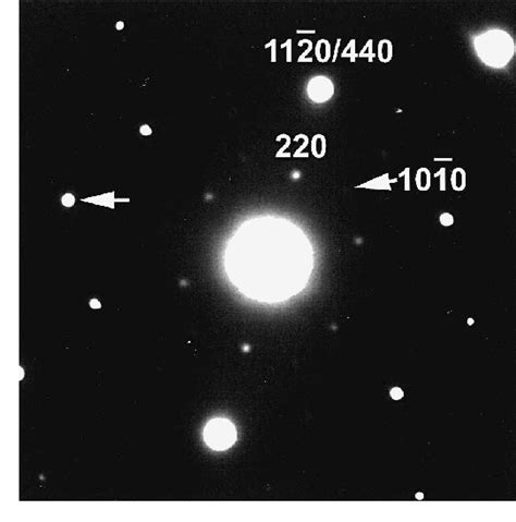 Figure 3 From Electron Microscopic Characterization Of