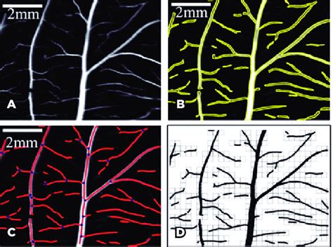 Detection Of Vascular Network Architecture A A Typical Image Download Scientific Diagram