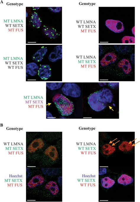 In Vitro Expression Of Variants In Hek293t Cells A Expression Of The