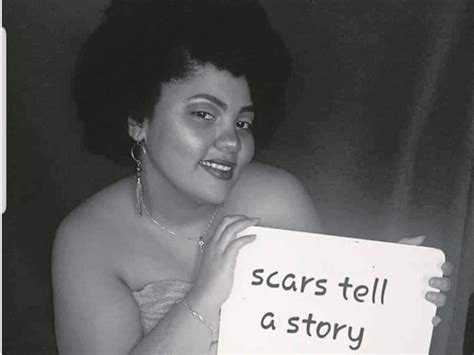 Kankerstryd Kry Miché Nie Onder Son