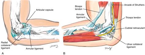 Lateral Epicondyle Injection