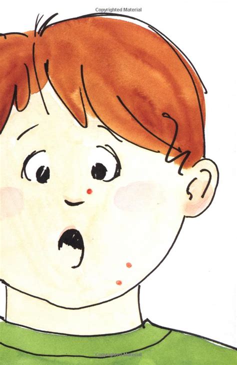 Scholastic Reader Level 1 Itchy Itchy Chicken Pox