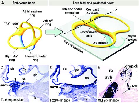 7 Lineage Analysis Of The Developing Atrioventricular Av Node In The Download Scientific